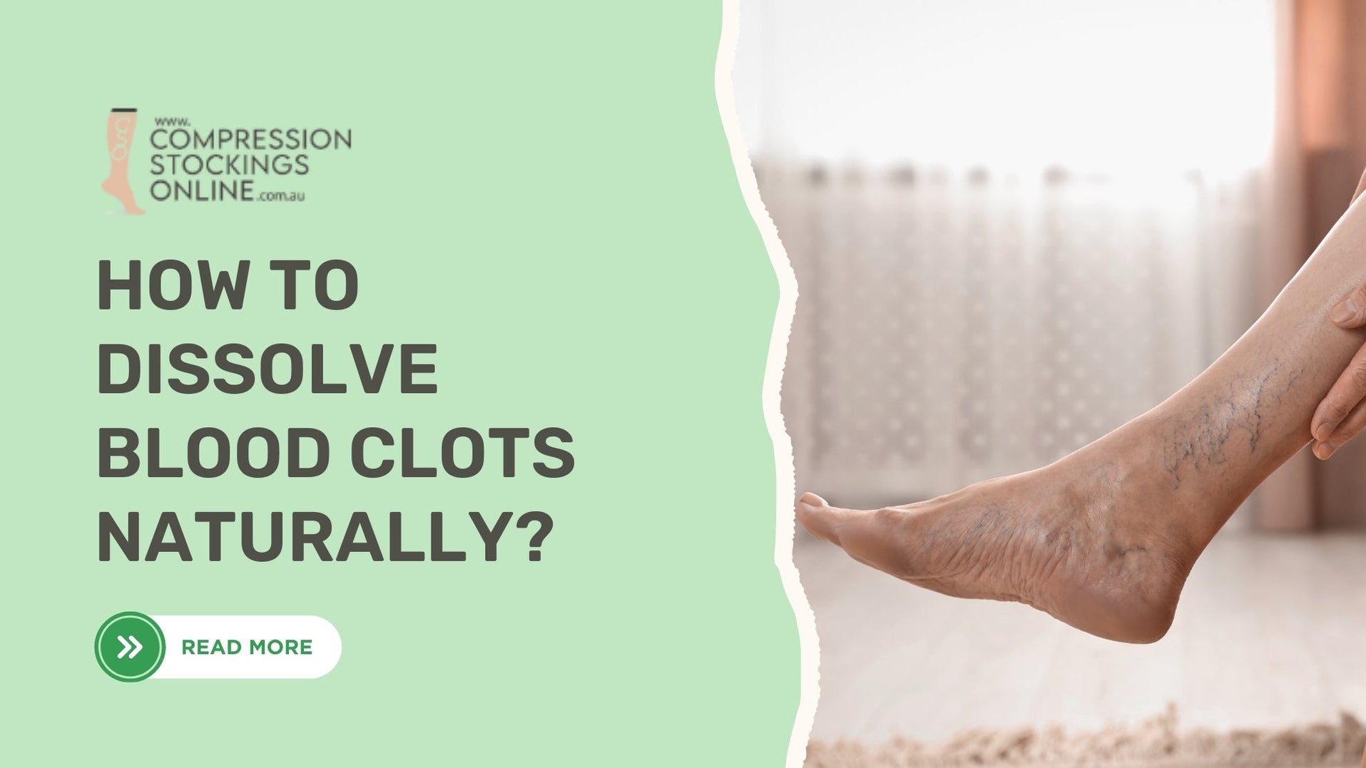 How to Dissolve Blood Clots Naturally?– Compression Stockings Online