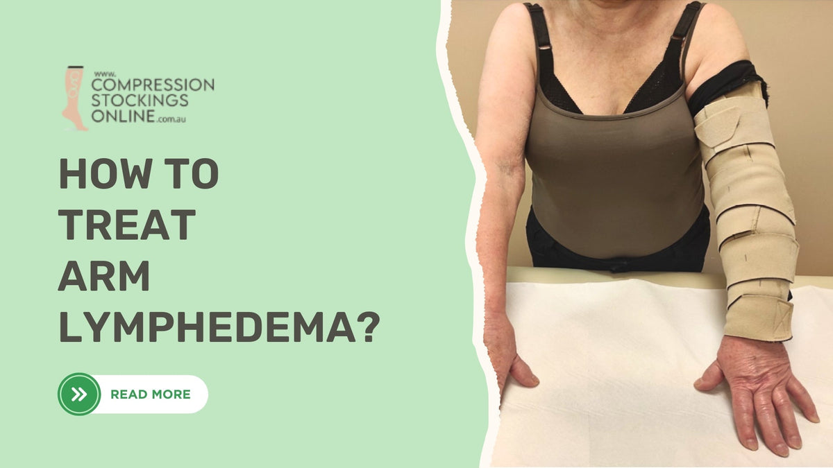 How to Treat Arm Lymphedema Step by Step for Comfort– Compression ...